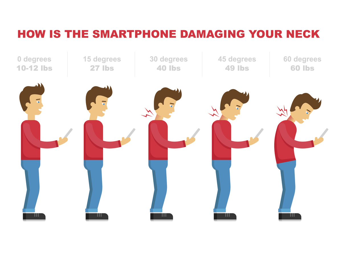 Neck Pain Treatment in Rohnert Park